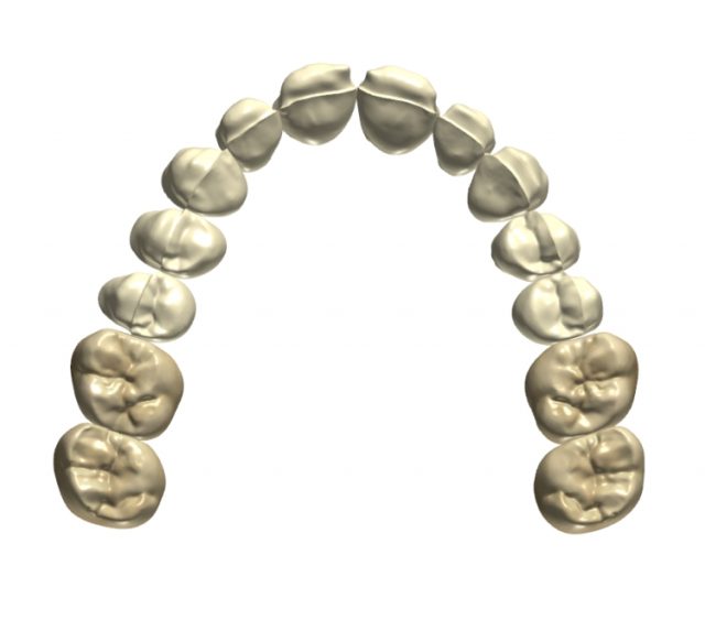 Coping – CAD Design – CAE Dental