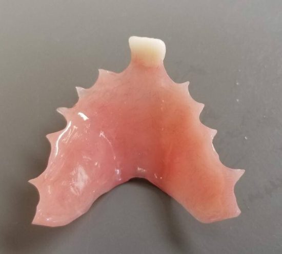 Flipper Partial - CAE Dental