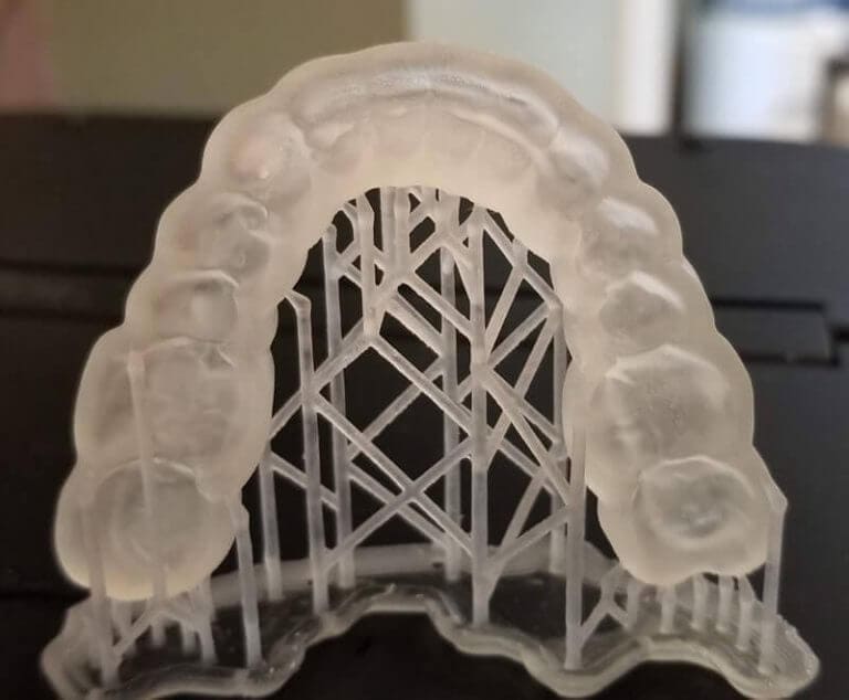 3D Printed Bite Splint - CAE Dental