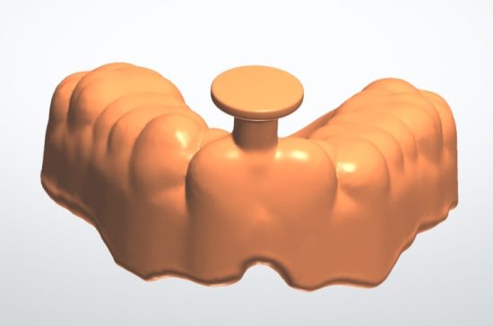 Custom Impression Tray – CAD Design – CAE Dental