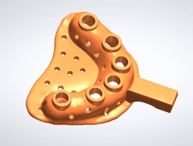 Custom Impression Tray – CAD Design – CAE Dental