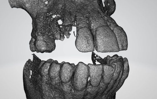 DCM to STL conversion – CAE Dental