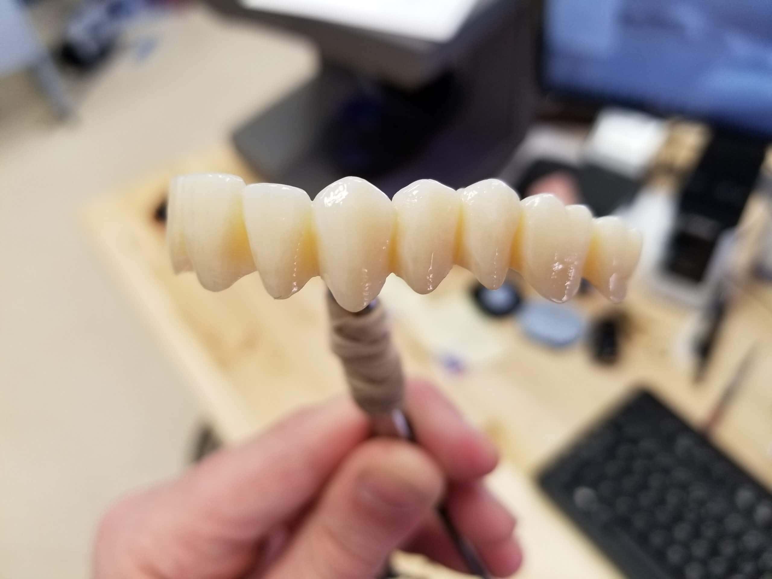 Fully 3D Printed Denture CAE Dental
