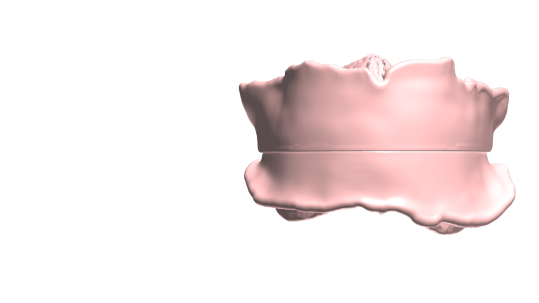 CAE Dental – Computer Aided Engineered Dentistry