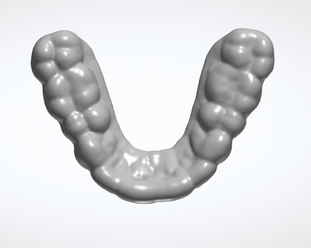 Night Guard – CAD Design – CAE Dental