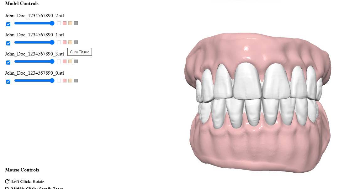3D Dental Design CAD Viewer – CAE Dental